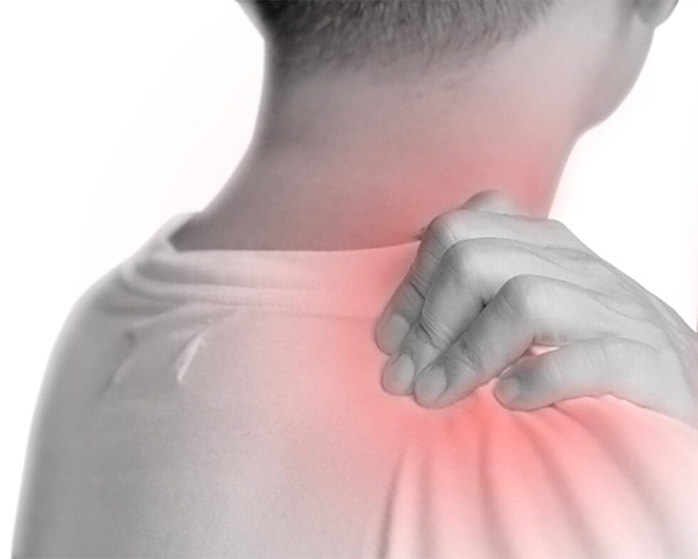 Thoracic Outlet Syndrome Treated at SCMSC in Los Angeles