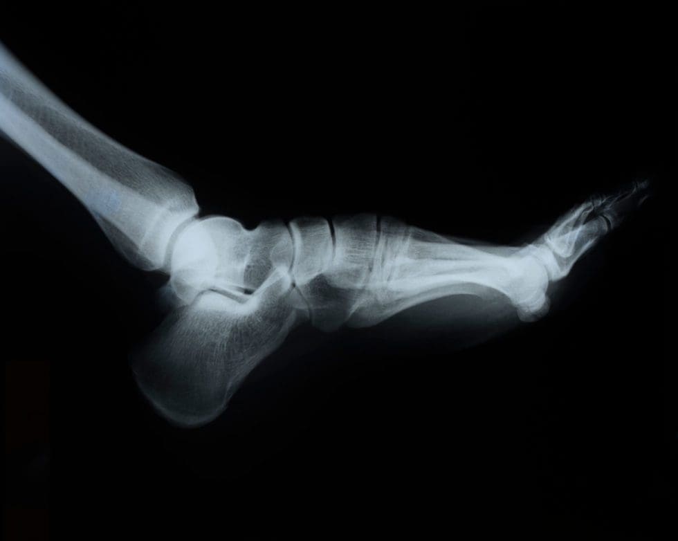 Foot and Ankle Trauma Treated | SCMSC